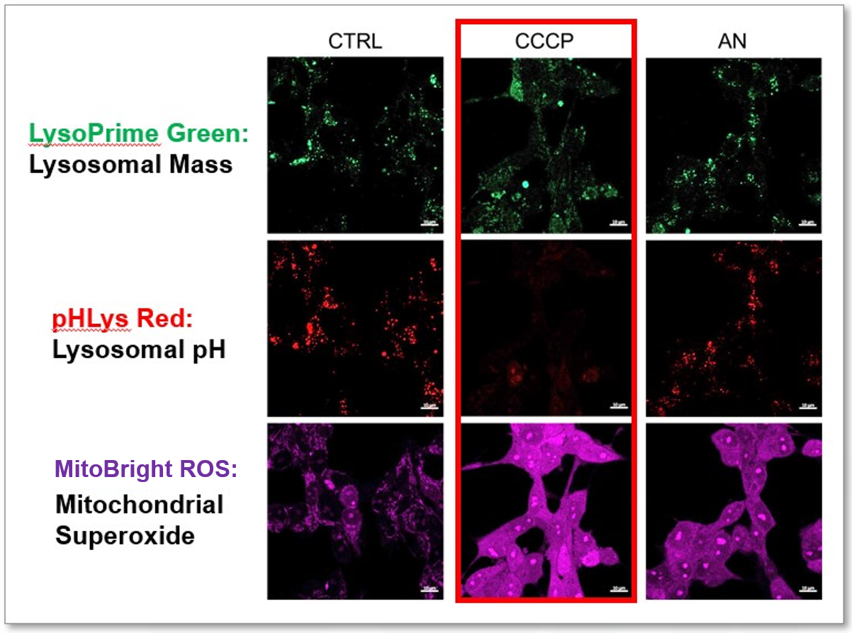 Applications for ROS, Autophagy, Endocytosis, Lysosome, and Metabolism ...