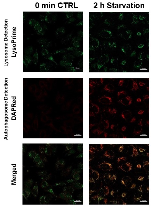 New Mitophagy Pathways: Next Therapy Targets? [Sep. 23, 2025] DOJINDO ...