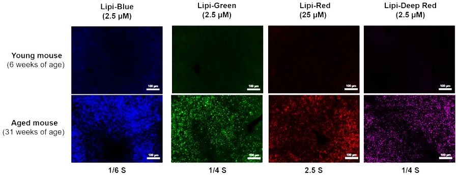 Association Between Cellular Senescence and Mitochondrial Disfunction ...