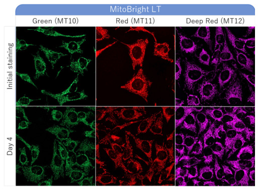 Association Between Cellular Senescence and Mitochondrial Disfunction ...