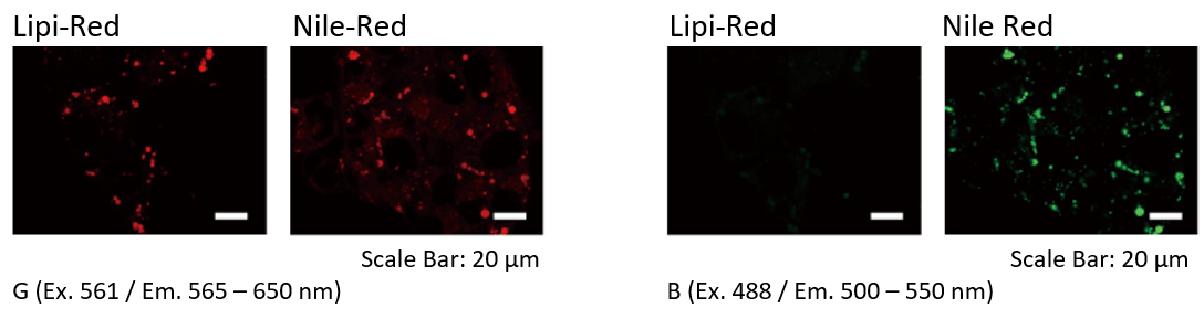 Lipid Droplet Staining Lipi-Green DOJINDO
